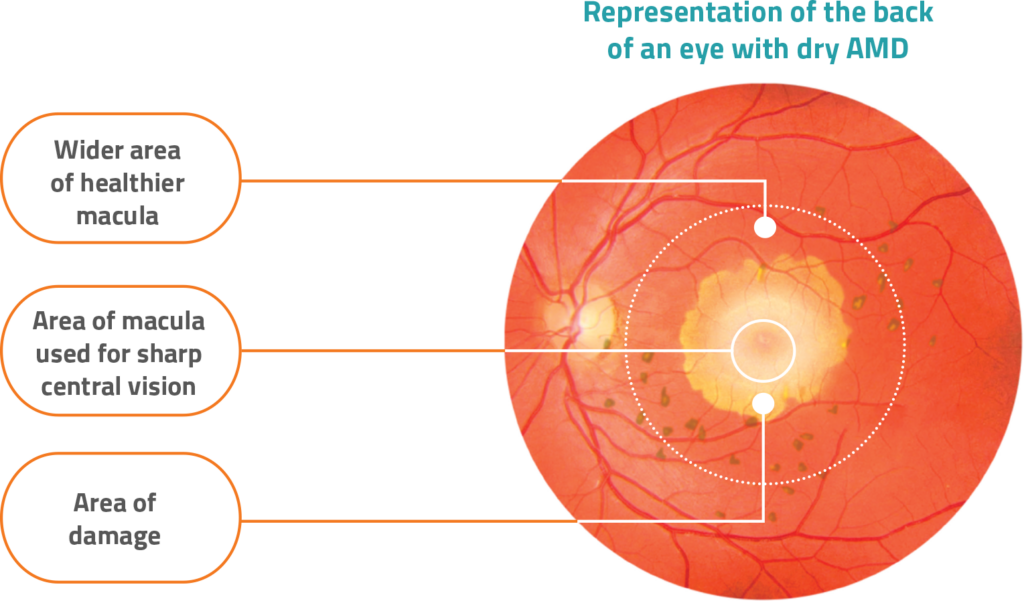 Sharpview Ophthalmology